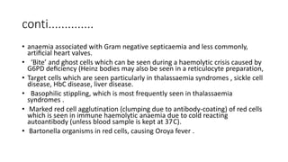 Types of anemias | PPTX
