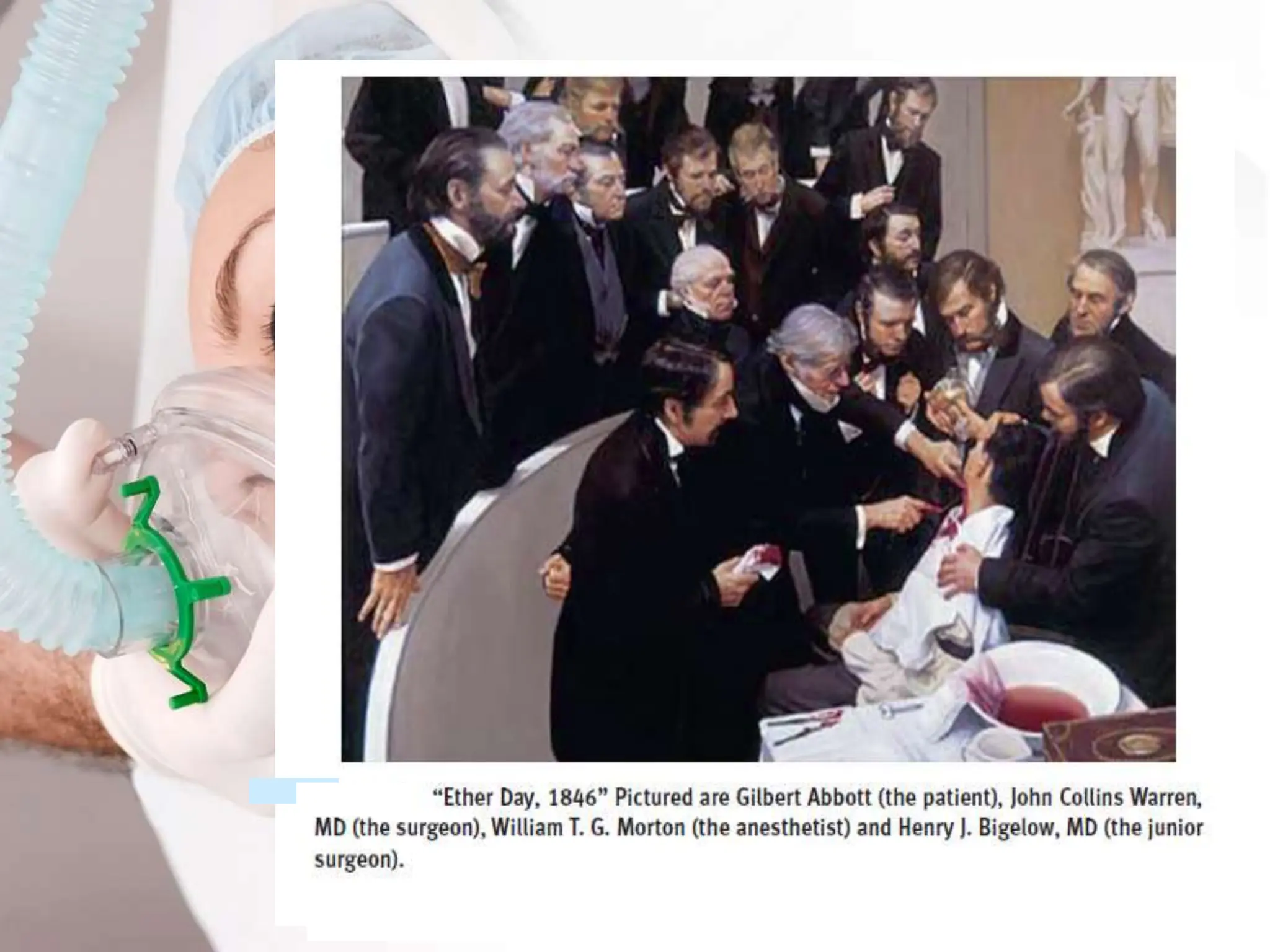 Anaesthesia types and classification for tech | PPT