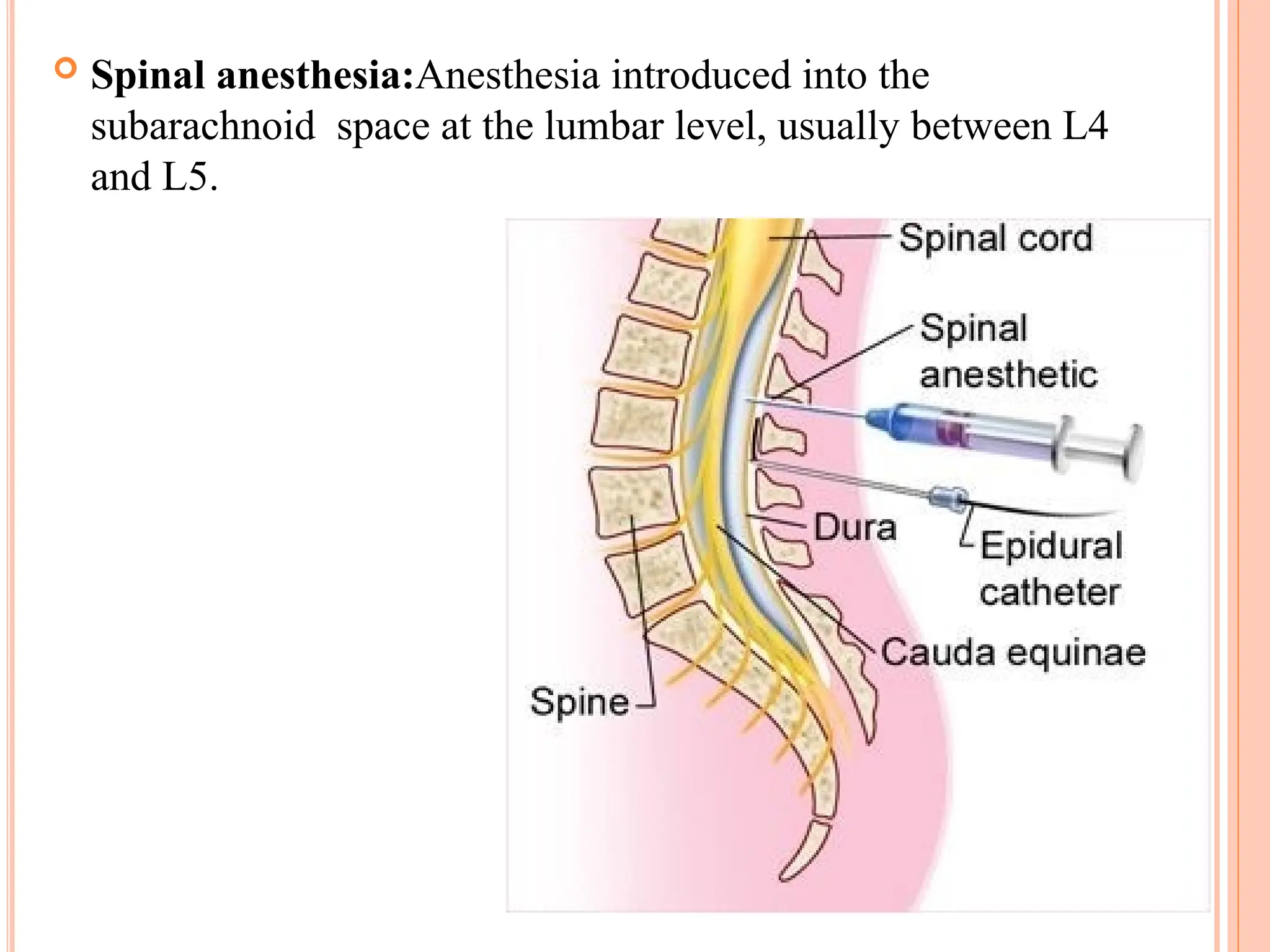 TYPES OF ANESTHESIA and its details.pptx