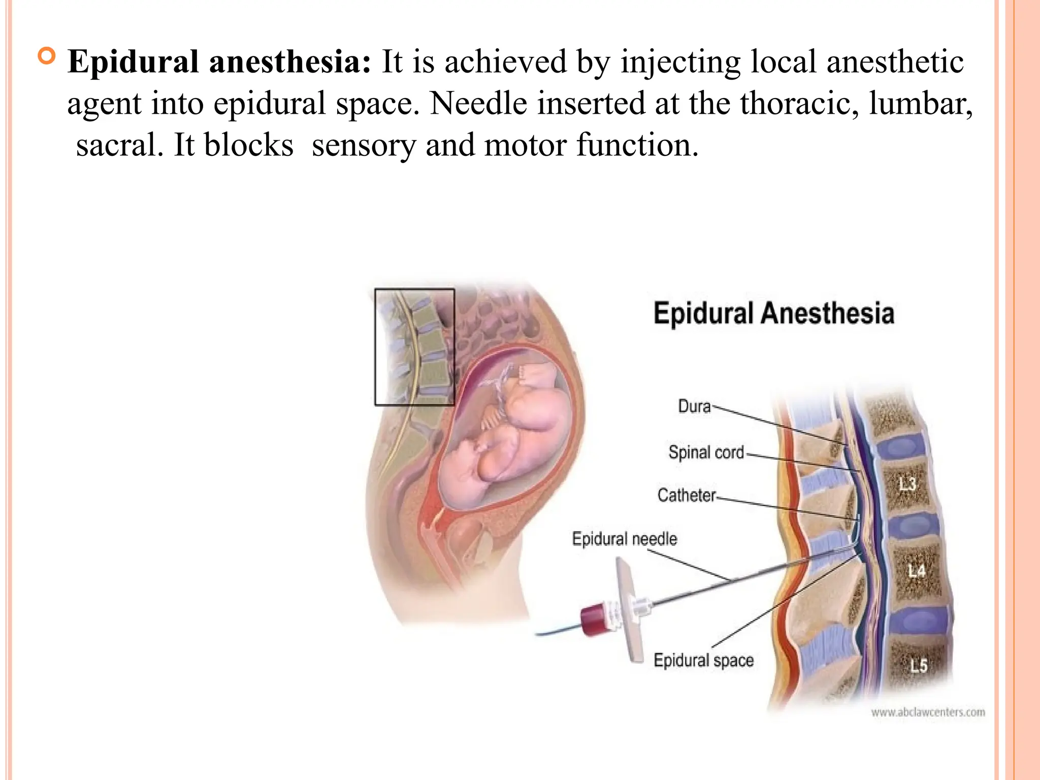 TYPES OF ANESTHESIA and its details.pptx