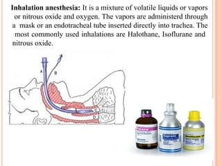 TYPES OF ANESTHESIA and its details.pptx
