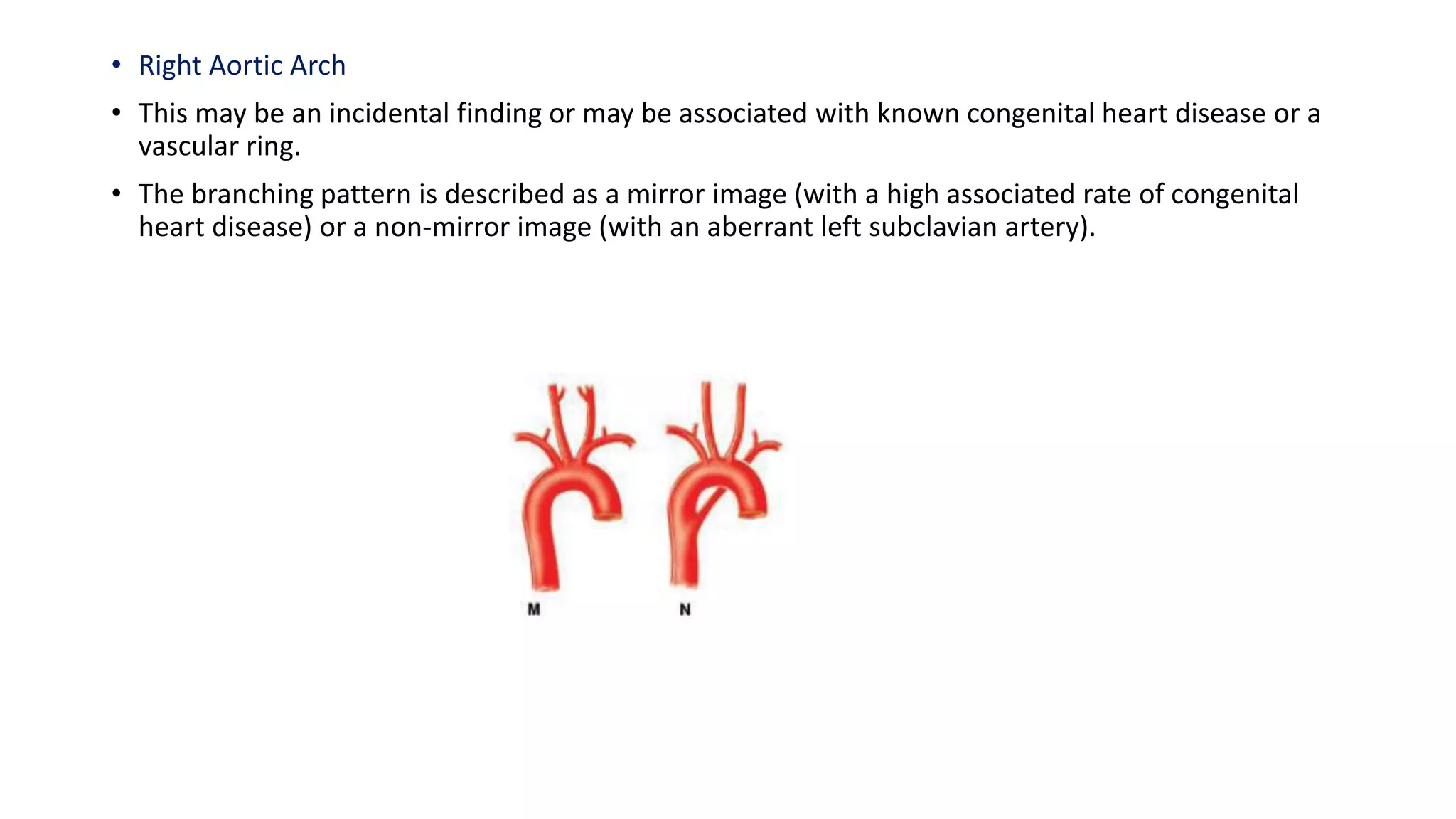 Types of aortic arch and navigation of difficult arches | PPTX