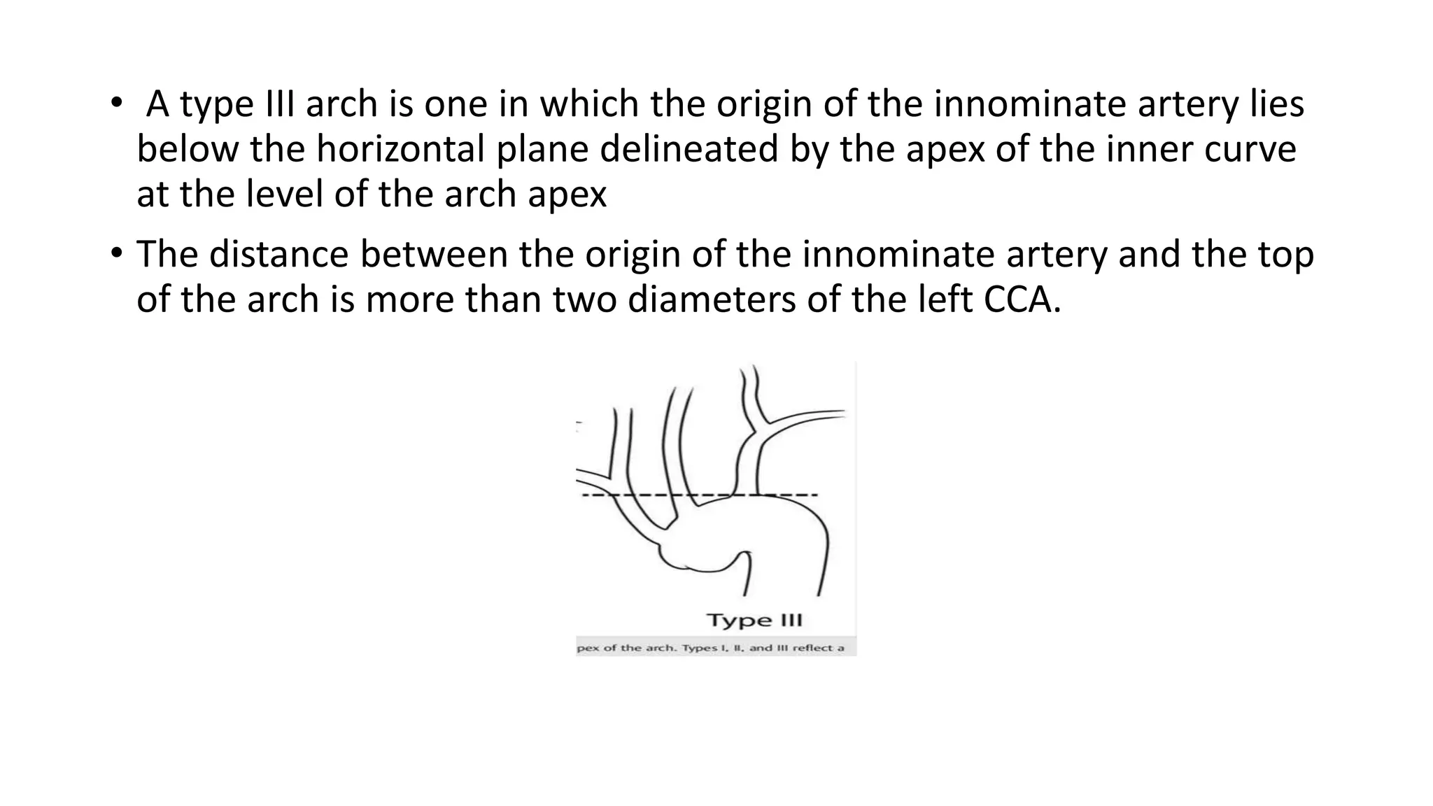 Types of aortic arch and navigation of difficult arches | PPTX