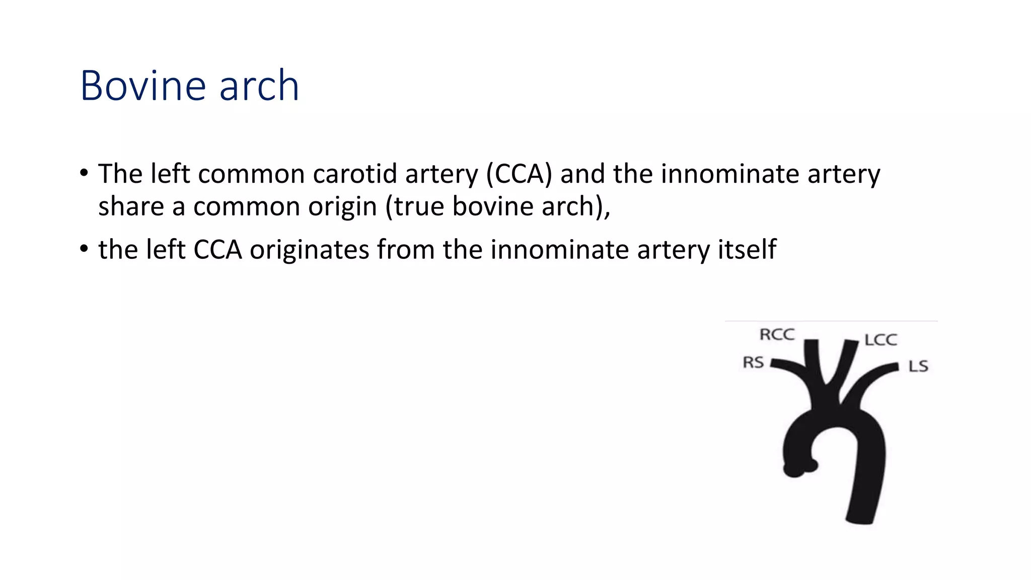Types of aortic arch and navigation of difficult arches | PPTX