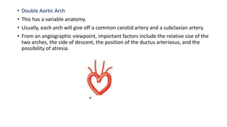 Types of aortic arch and navigation of difficult arches | PPTX