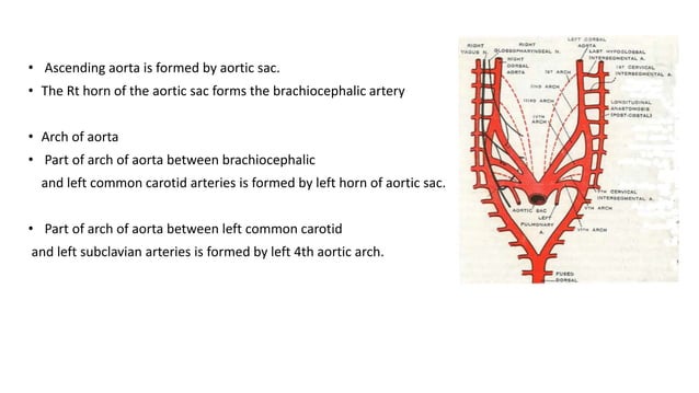 Types of aortic arch and navigation of difficult arches | PPTX | Heart ...