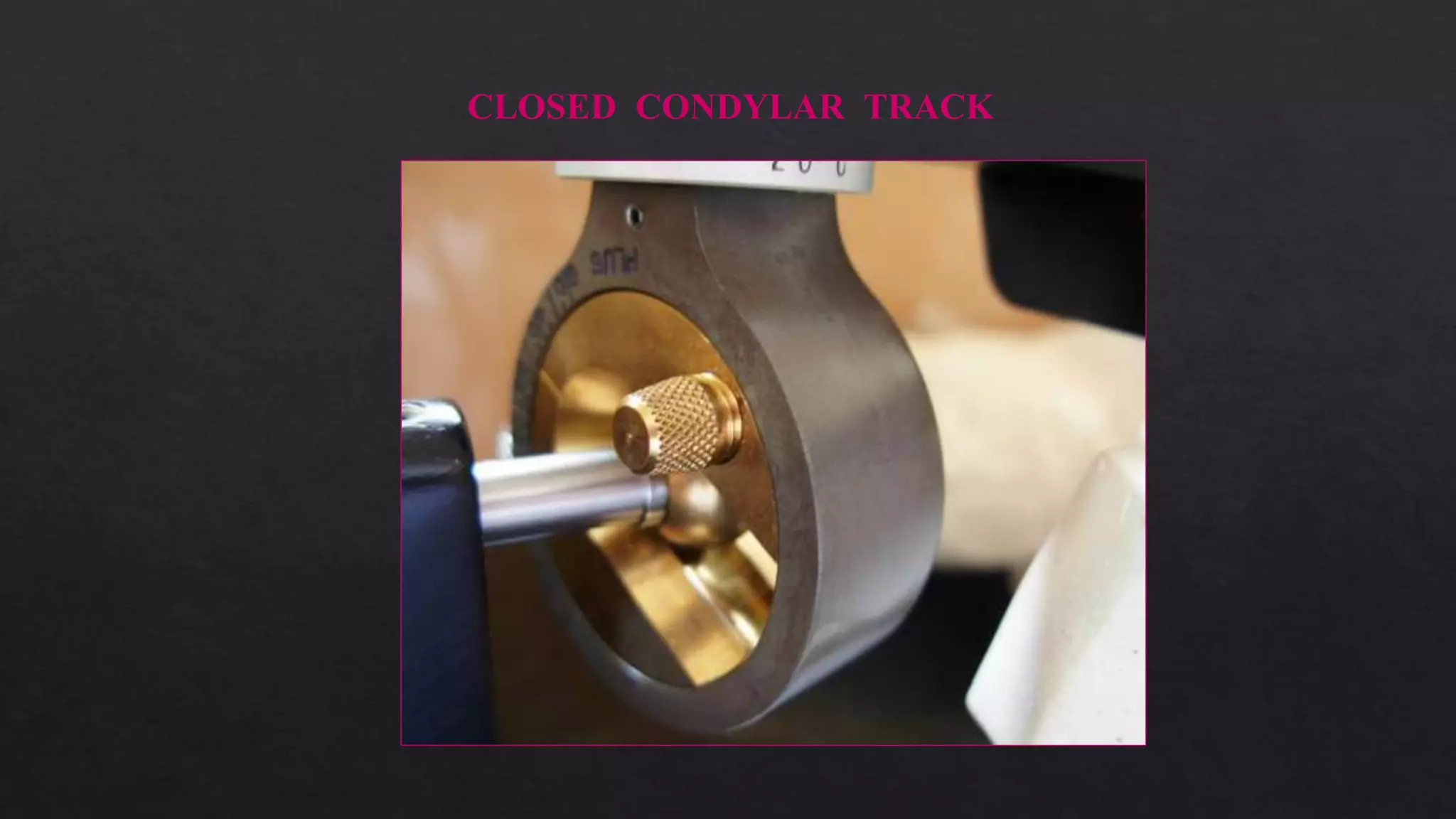 Types of articulators | PPTX