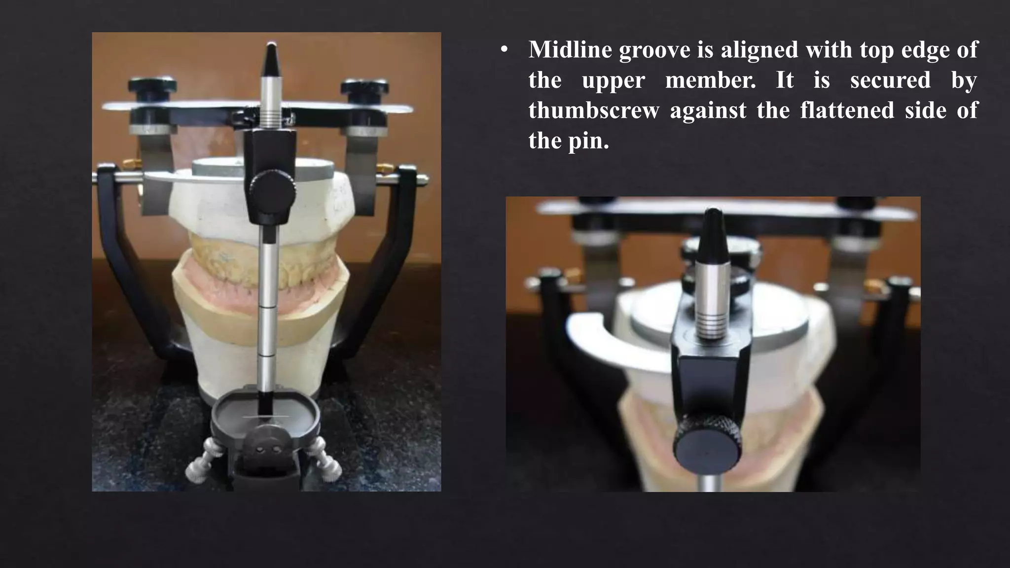 Types of articulators | PPTX