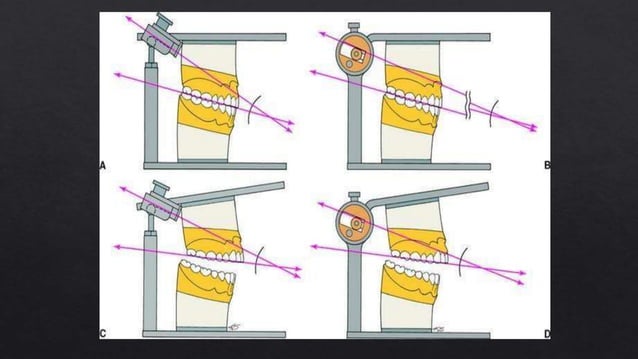 Types of articulators | PPTX | Dental Health | Diseases and Conditions