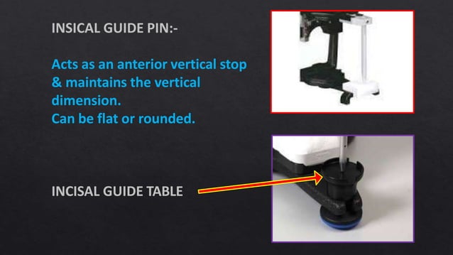Types of articulators | PPTX | Dental Health | Diseases and Conditions