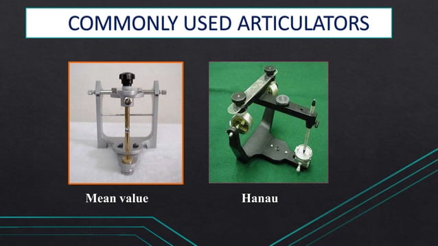 Types of articulators | PPTX | Dental Health | Diseases and Conditions