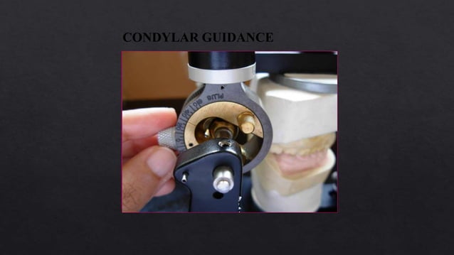 Types of articulators | PPTX | Dental Health | Diseases and Conditions