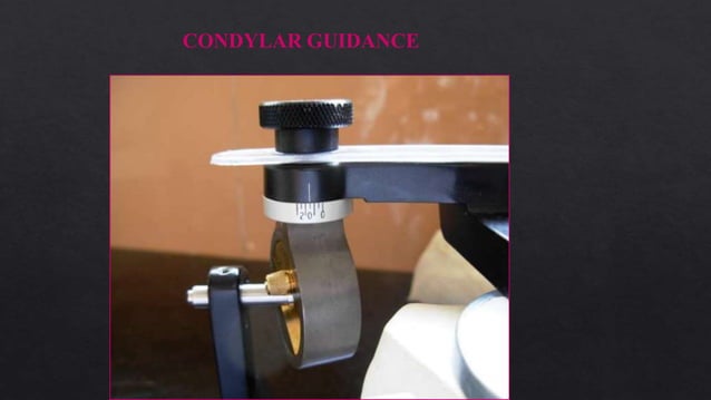 Types of articulators | PPTX | Dental Health | Diseases and Conditions