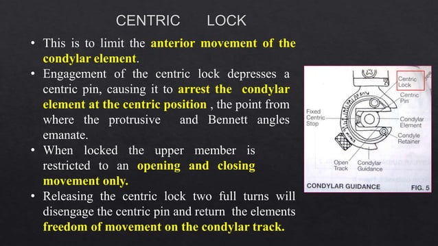 Types of articulators | PPTX | Dental Health | Diseases and Conditions