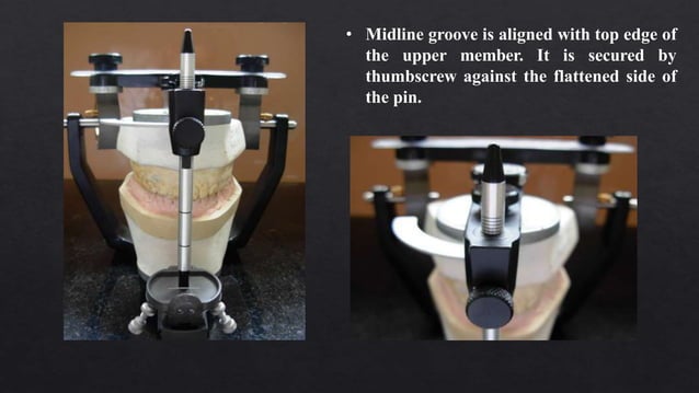 Types of articulators | PPTX | Dental Health | Diseases and Conditions