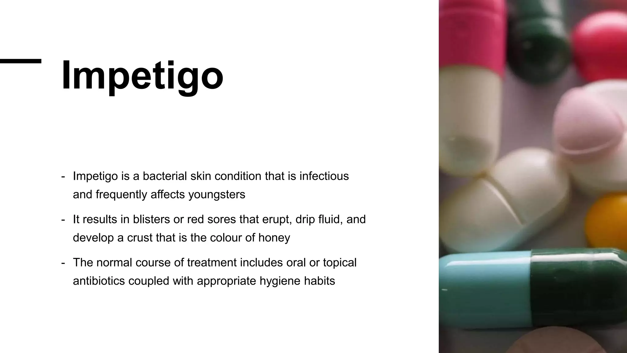 TYPES OF AUTOIMMUNE SKIN DISEASES_.pptx