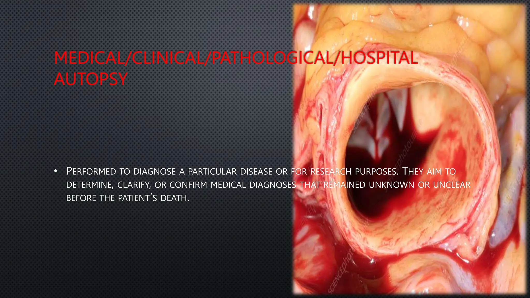 A brief overview of the different types of autopsy | PPTX
