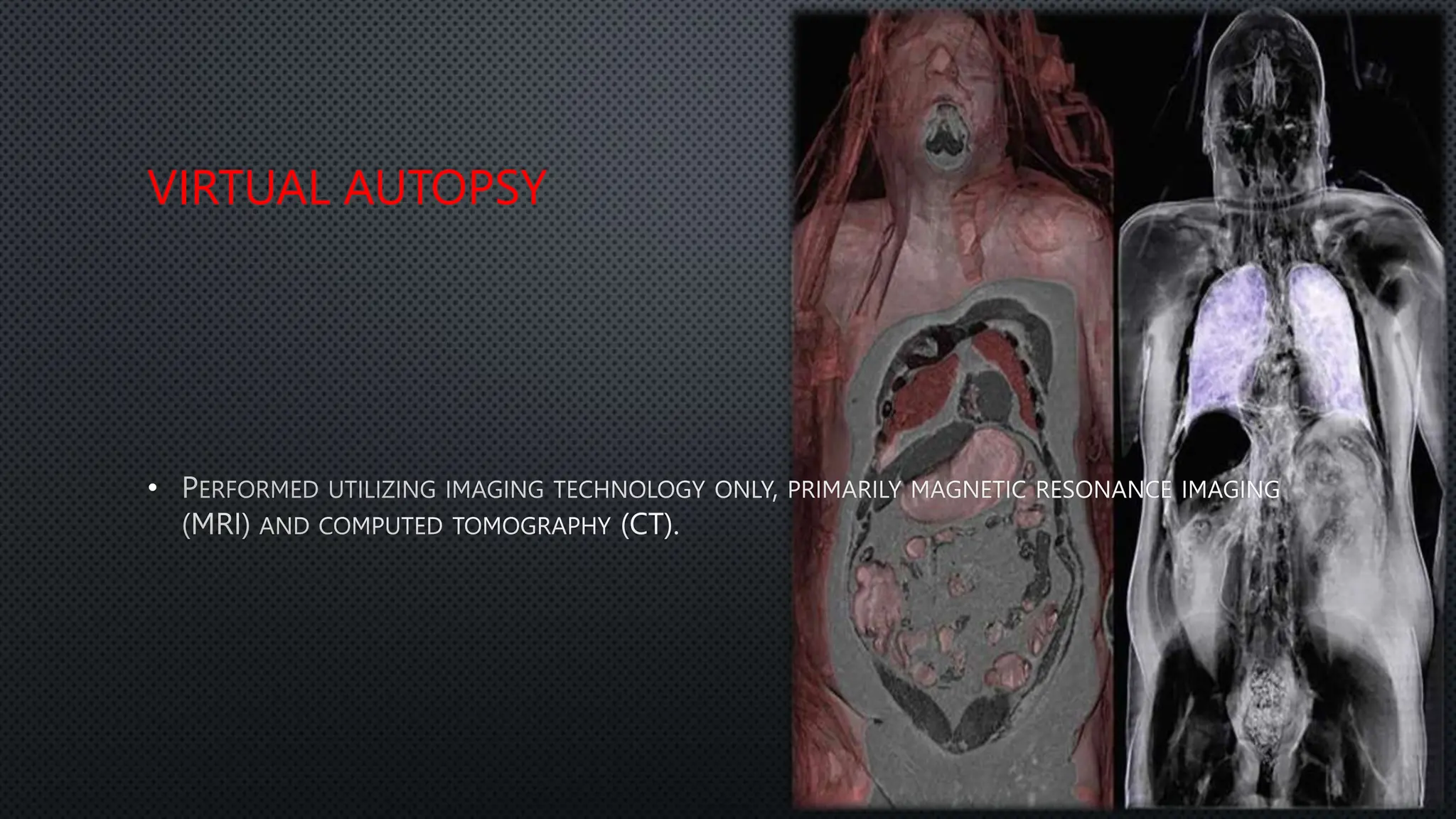 A brief overview of the different types of autopsy | PPTX