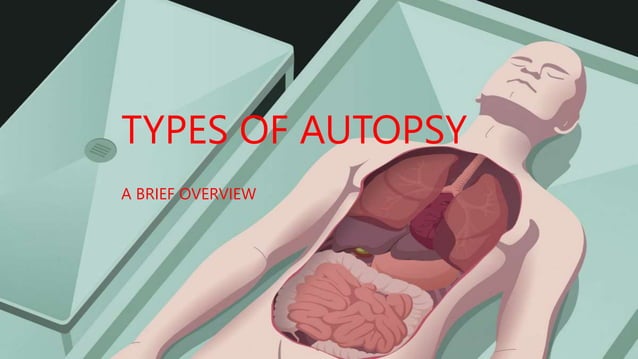 A brief overview of the different types of autopsy | PPT