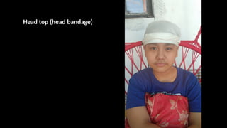 Types of Bandaging Types of Bandaging Types of Bandaging | PPTX