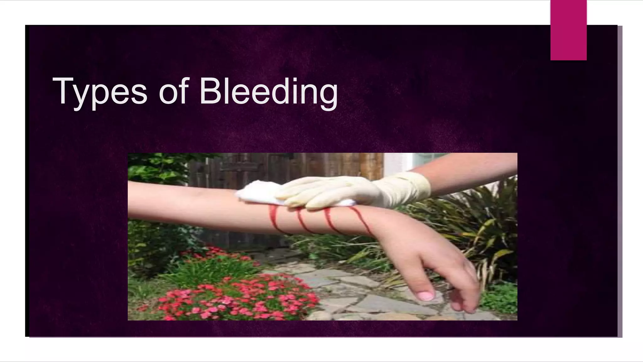 Types of bleeding ppt | PPTX