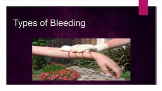 Types of bleeding ppt | PPTX