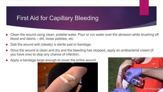 Types of bleeding ppt | PPTX