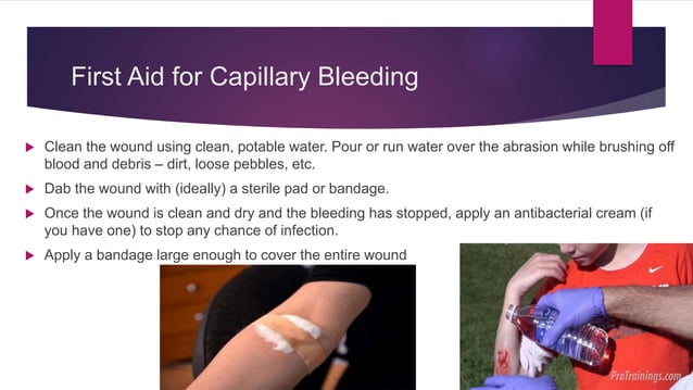 Types of bleeding ppt