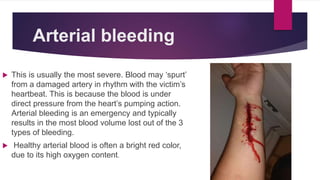 Arterial Bleeding