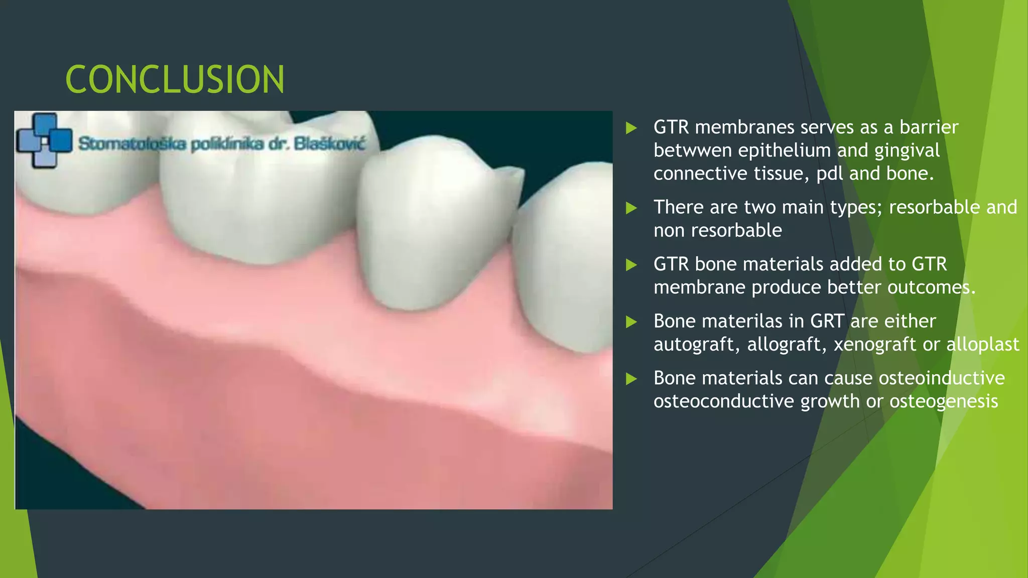 Types of bone and membrane used in guided tissue regeneration | PPTX