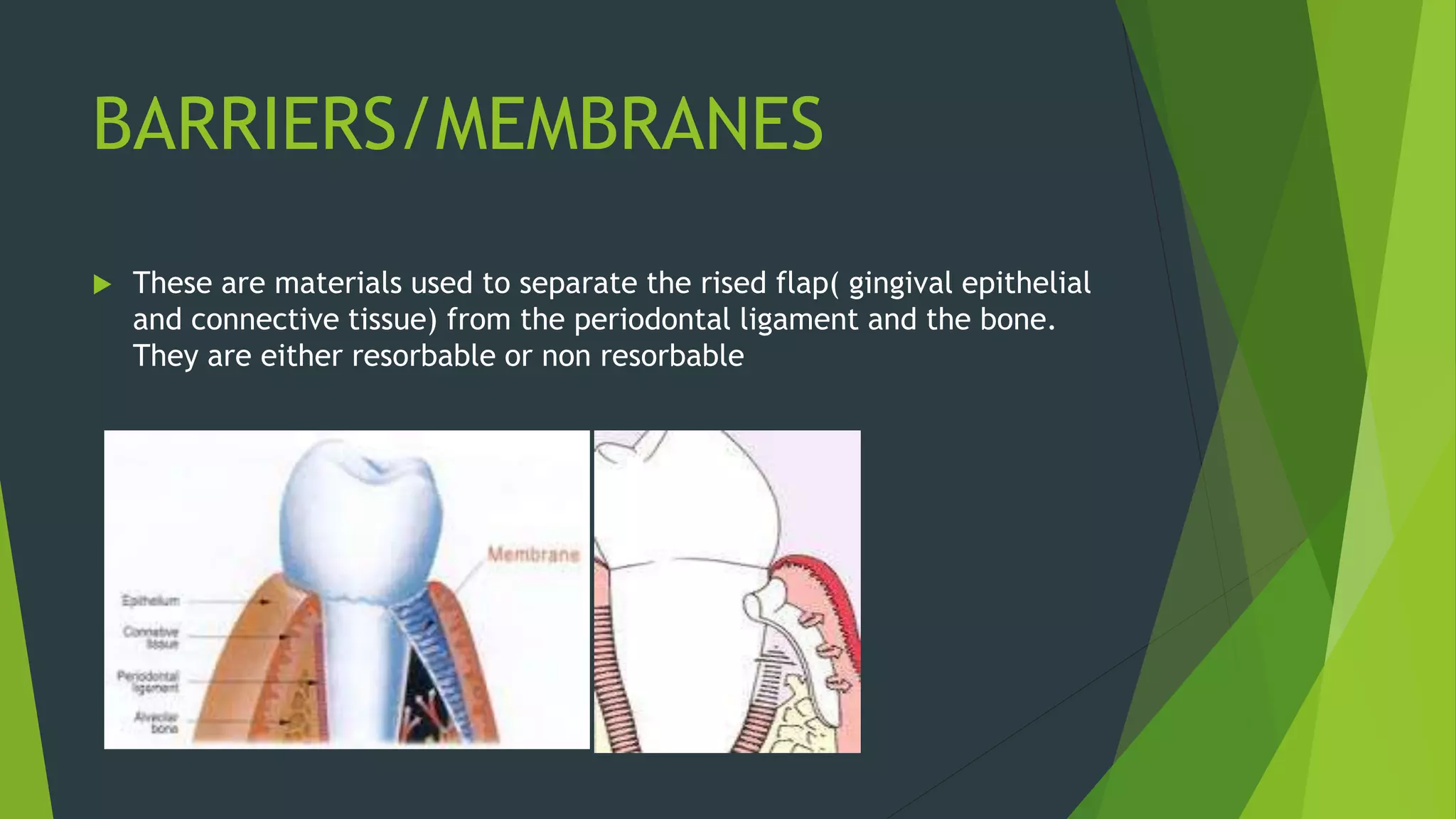 Types of bone and membrane used in guided tissue regeneration | PPTX