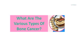 Types of Bone Cancer | PPT