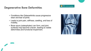 What are the different types of bone deformities? | PDF