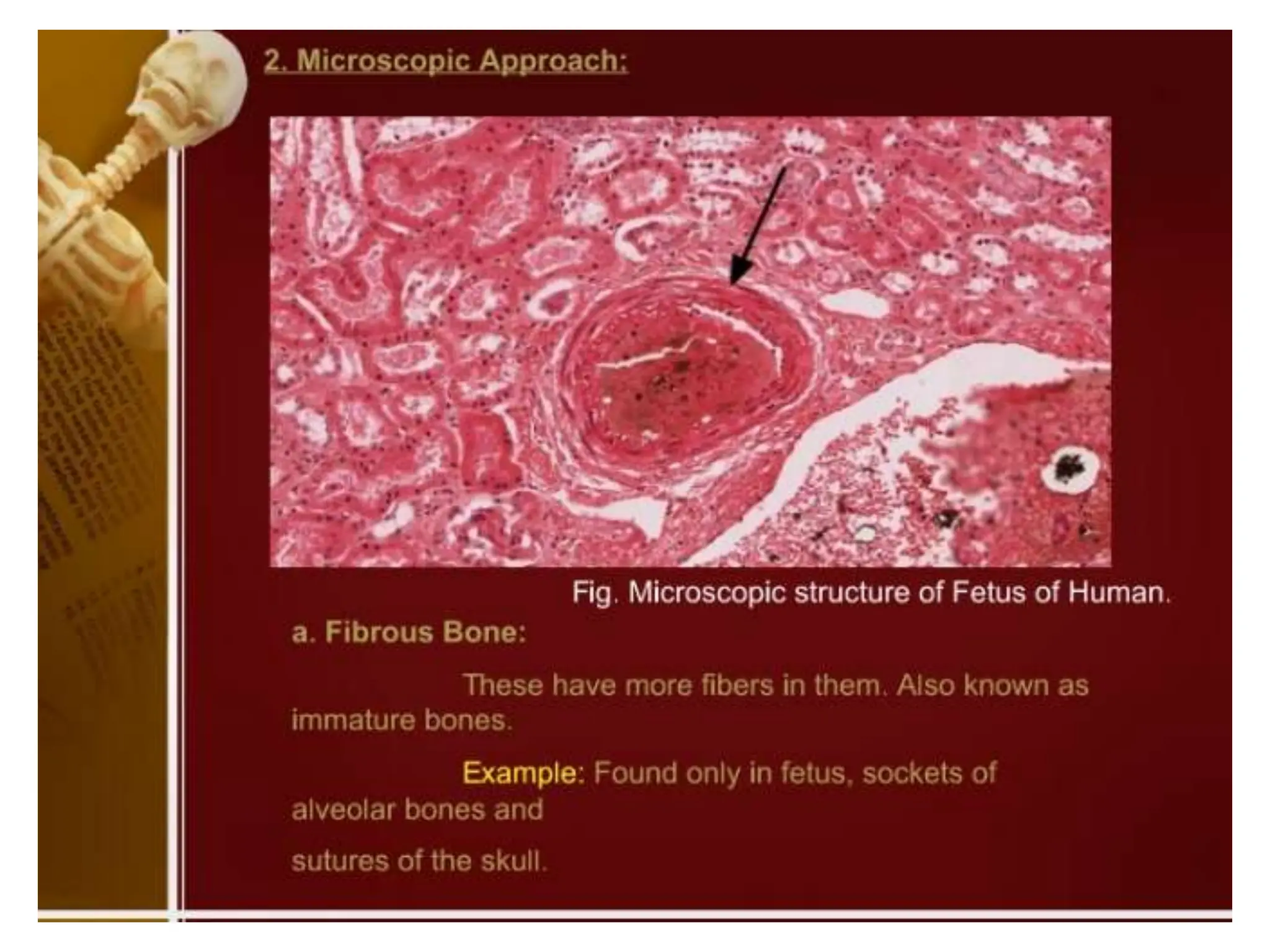 Definition,Types and classification of bones.ppt