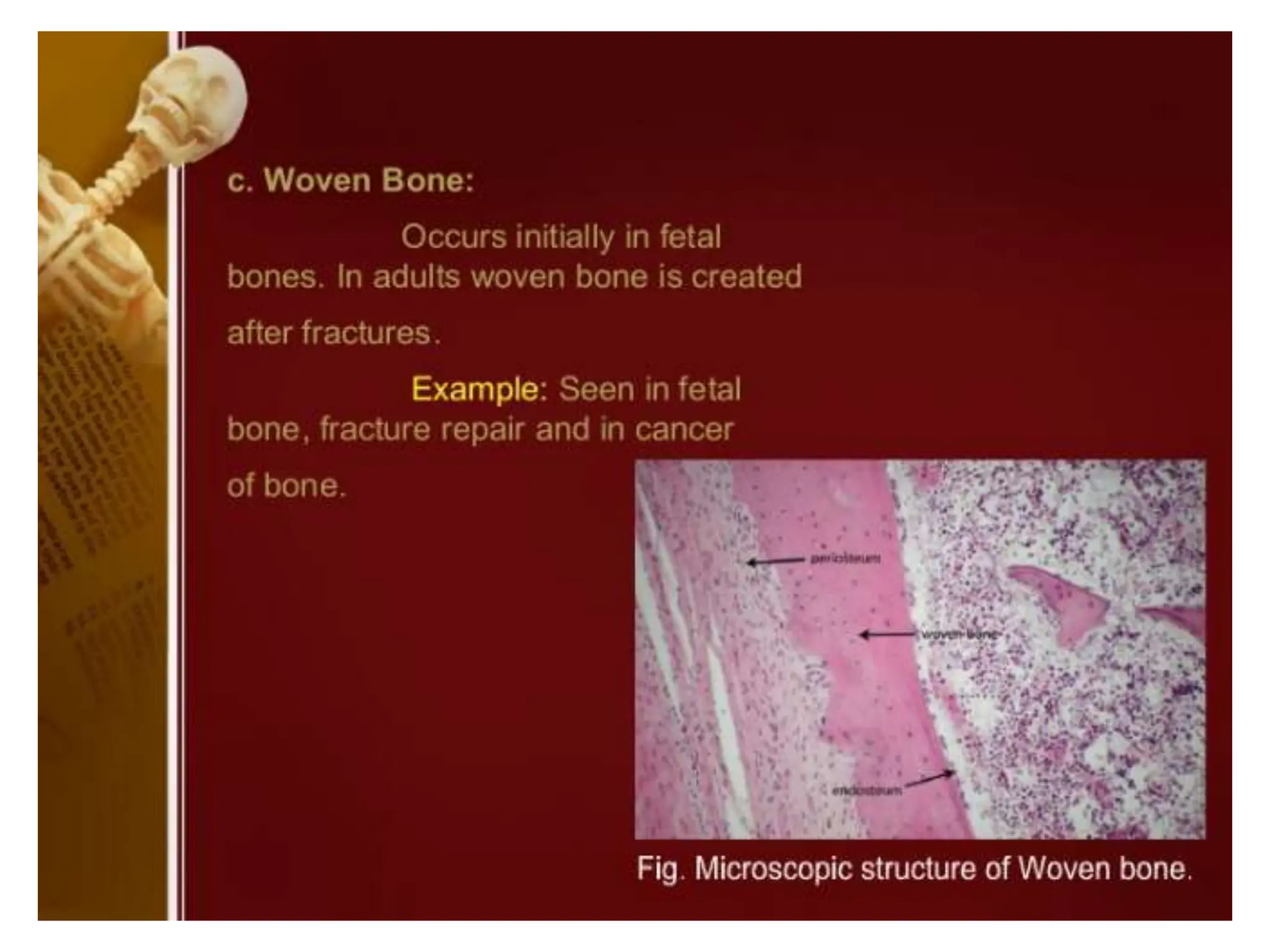 Definition,Types and classification of bones.ppt