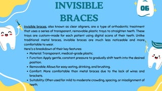 Types of Braces that are provided by - lvdentalsquare | PPT