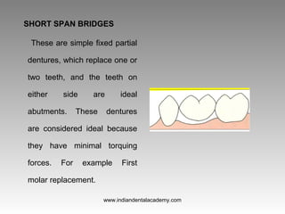 Types of Dental bridges (FPD) / dental implant courses | PPT