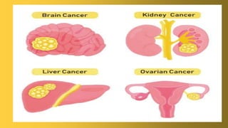 TYPES OF CANCER.pptx