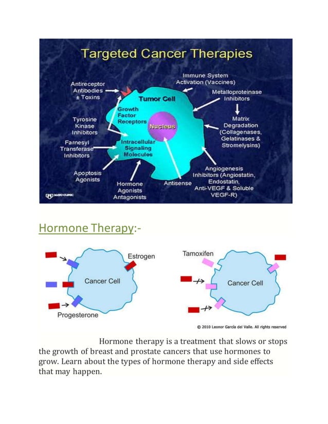 Types of cancer treatment | PDF