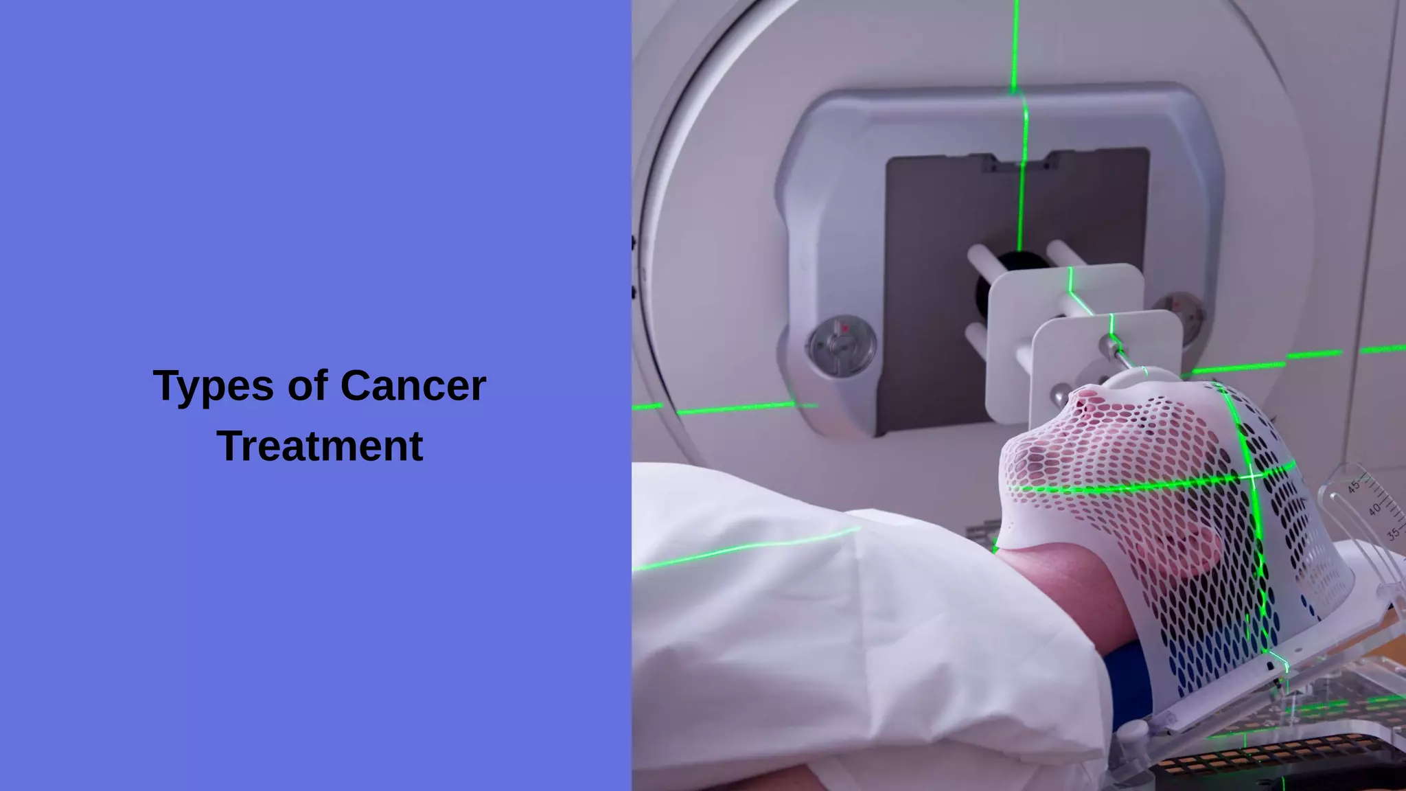 Types of Cancer Treatment.pptx