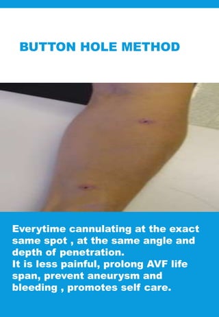 Types of cannulation | PPTX