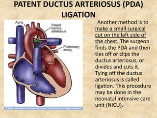 Types of cardiac surgeries | PPT