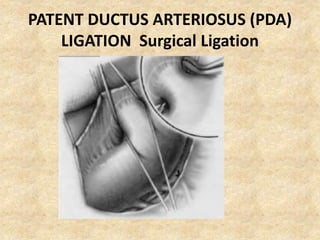 Types of cardiac surgeries | PPT
