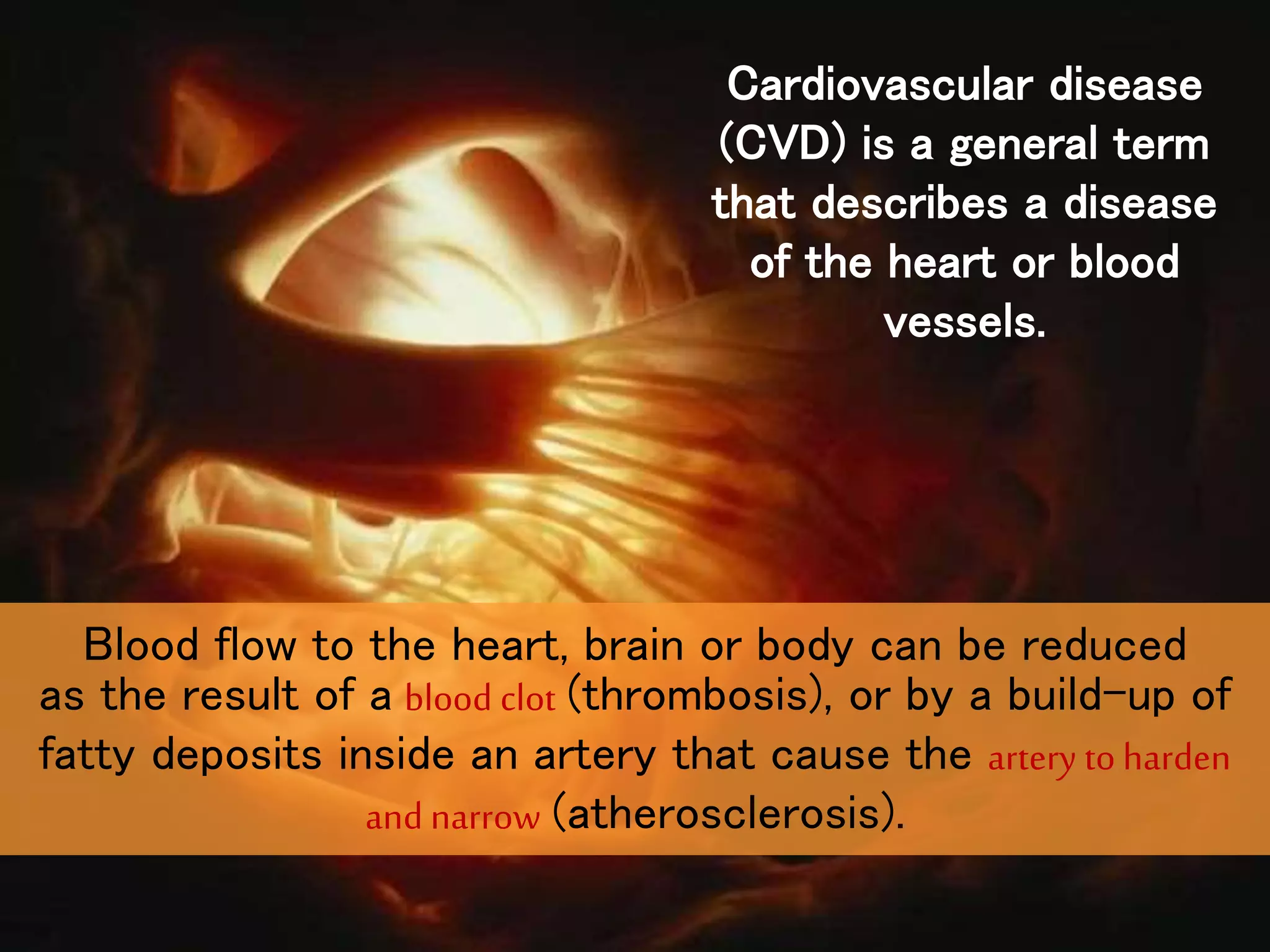 Types of cardiovascular diseases | PPTX