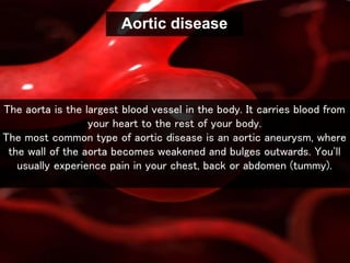 Types of cardiovascular diseases | PPTX