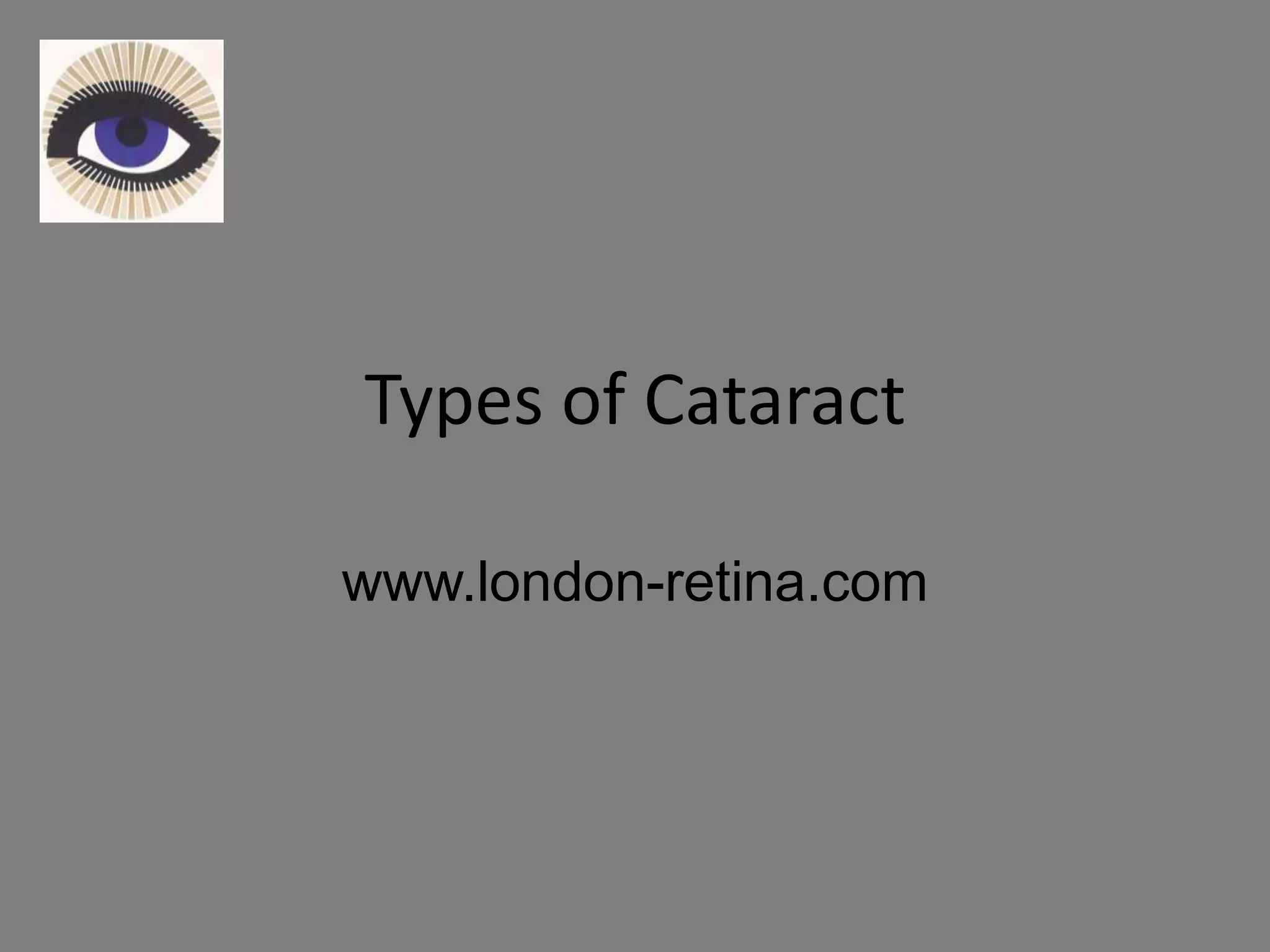 Types of cataract | PPTX