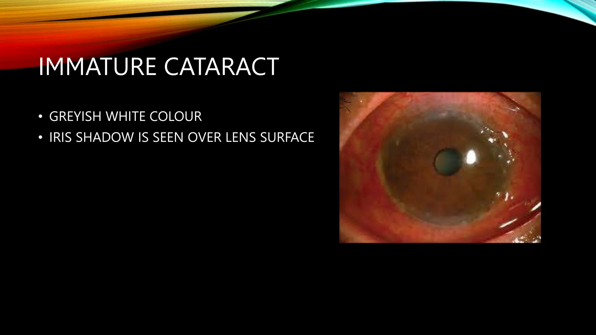 TYPES , SIGNS AND SYMPTOMS OF CATARACT.pptx