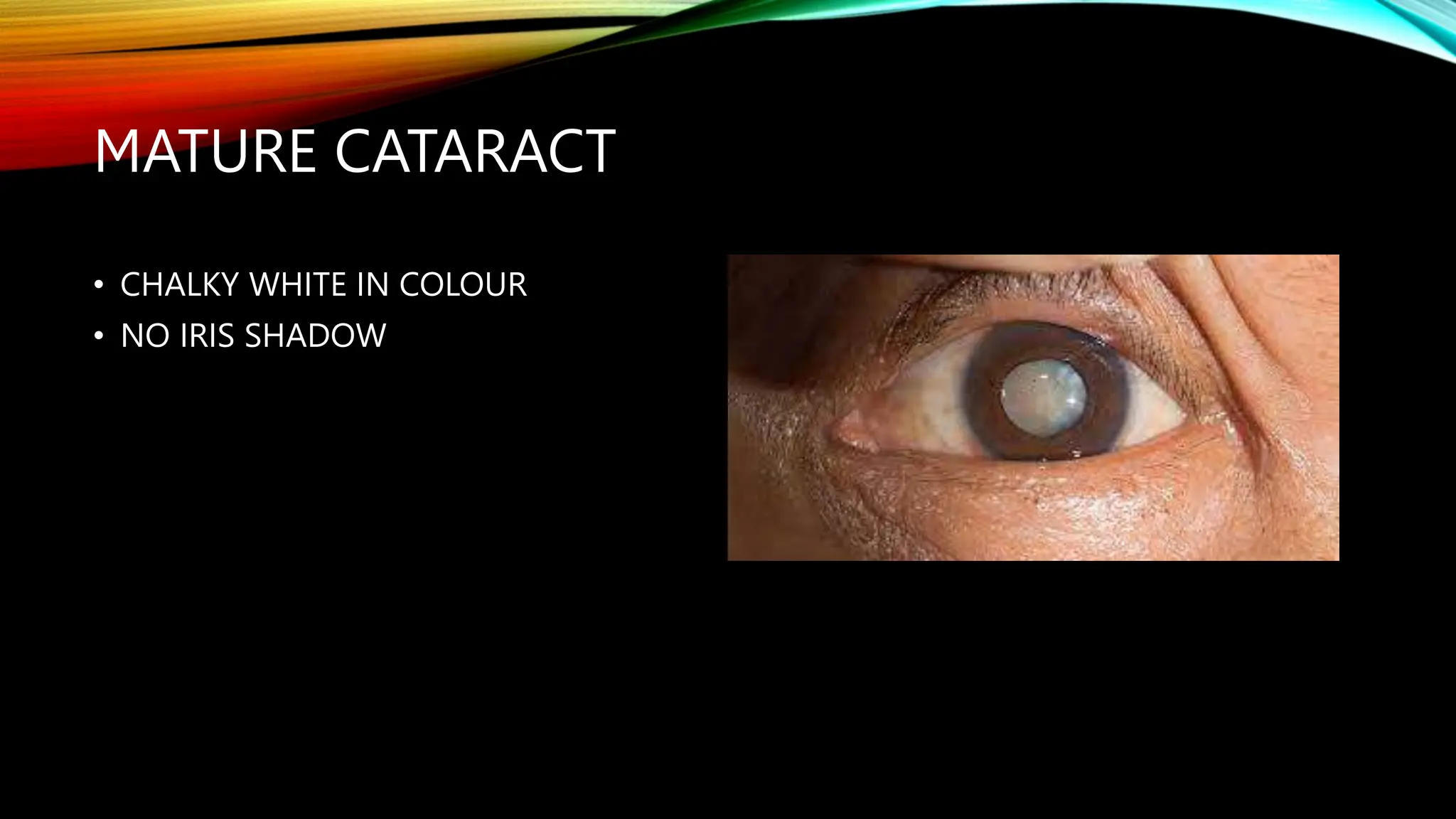 TYPES , SIGNS AND SYMPTOMS OF CATARACT.pptx