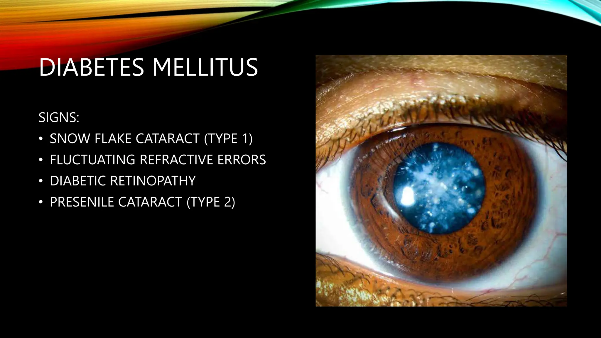 TYPES , SIGNS AND SYMPTOMS OF CATARACT.pptx