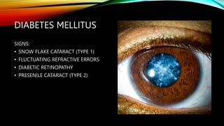 TYPES , SIGNS AND SYMPTOMS OF CATARACT.pptx